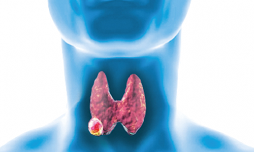 Tiroid Bezi Hastalıkları